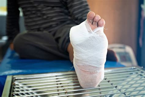 How Does Diabetes Affect The Feet The Healing Sole