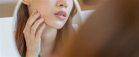 여성 아시아인은 얼굴이 걱정됩니다 피부과 및 화장품의 스테로이드에 알레르기가 있습니다 민감 피부 햇볕에 의한 붉은 얼굴 여드름 화학 물질 알레르기 얼굴에 발진 피부 트러블과