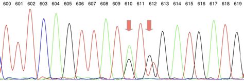 Sanger Sequence Sequencing Kits Test It