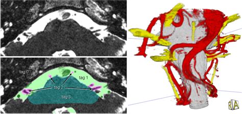 4 Segmentation Of Important Anatomical Structures Backroundtag 0 Download Scientific