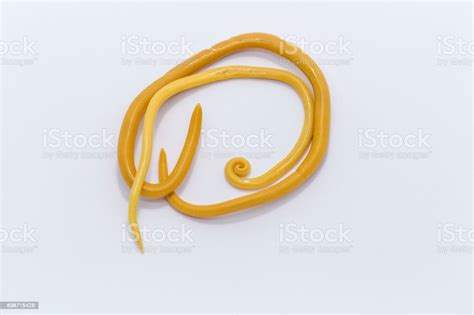 Ascariasis Is A Disease Caused By The Parasitic Roundworm Ascaris