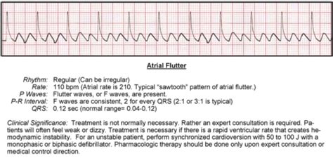 Conduction Disorders Atrial Flutter Flashcards Quizlet