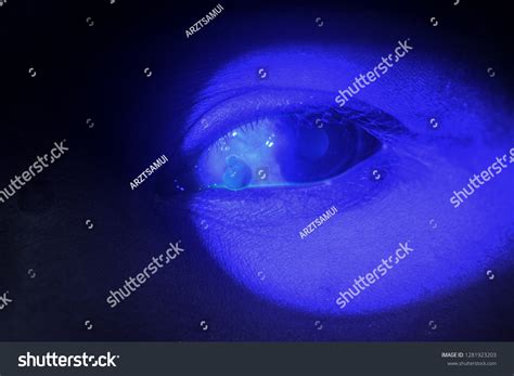 Close Pyogenic Granuloma During Eye Examination库存照片1281923203 Shutterstock