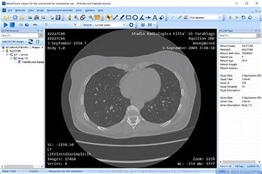 DICOM File What Is A Dicom File And How Do I Open It