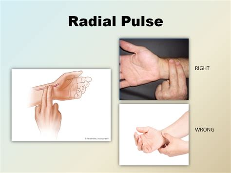 Radial Pulse