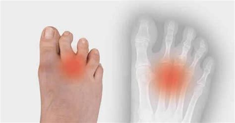 Voet En Enkel Orthopedie Dendermonde