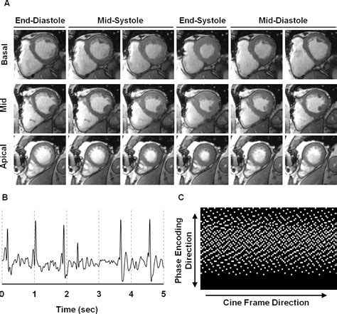 Accelerated Cardiac Mri Cine With Use Of Resolution Enhancement Generative Adversarial Inline