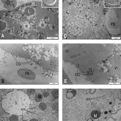 Transmission Electron Micrographs Of Mature Bovine Oocytes Produced By