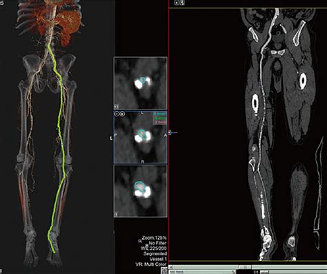 Multi Modality Modality Applications Healthcare It Products Canon Medical Systems Usa