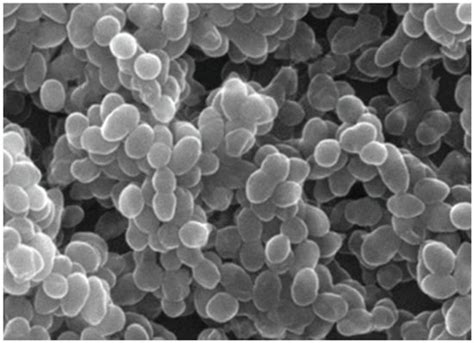 A Review Of Detection Methods For Vancomycin Resistant Enterococci Vre