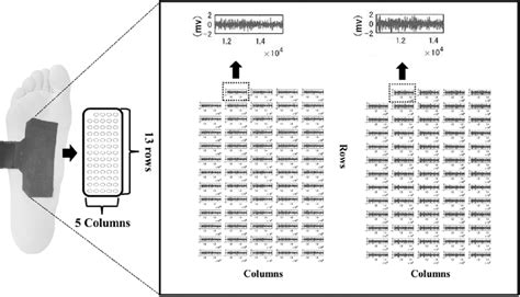 Electrode Placement Location In The Sole Of A Foot The Electrode Grid Download Scientific