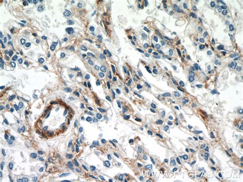 18243 1 Ap Proteintech Group Txnip Antibody Antibodypedia