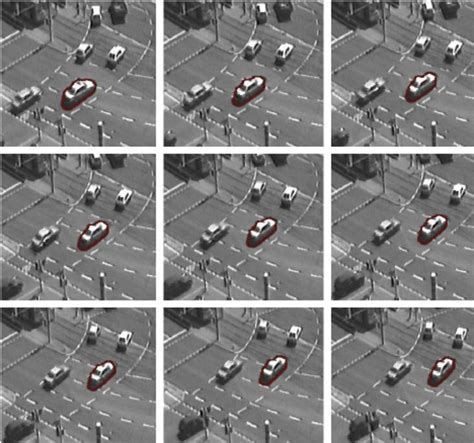 Segmentation Of The Corpus Callosum Download Scientific Diagram