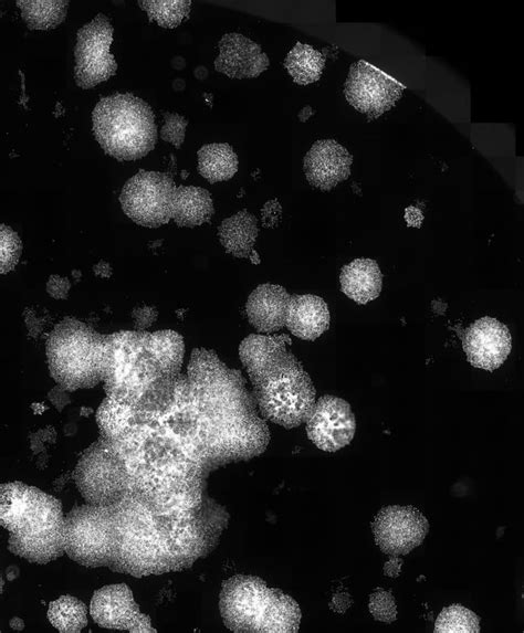 Can Colony Counting Plugin Be Used To Count Cell Colonies And If So How