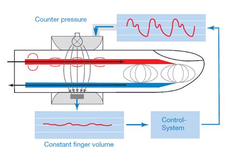 Cnap Lidco Hemodynamic Monitoring For The Entire Patient Pathway