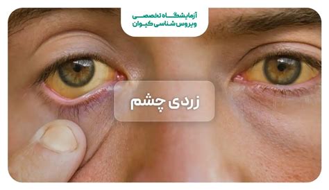 انواع خود ارضایی چیست؟ چرا خود ارضایی عوارض جدی دارد؟