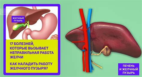 17 болезней которые вызывает неправильная работа желчи Как наладить работу желчного пузыря