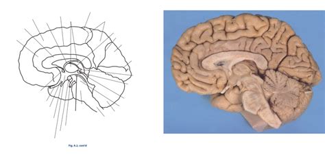 Sagittal Cross Section For Exam 1 Diagram Quizlet
