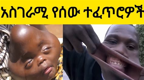 8 አስደንጋጭ ና አስገራሚ የሰውነት ተፈጥሮ ያላቸው ሰዎች Youtube
