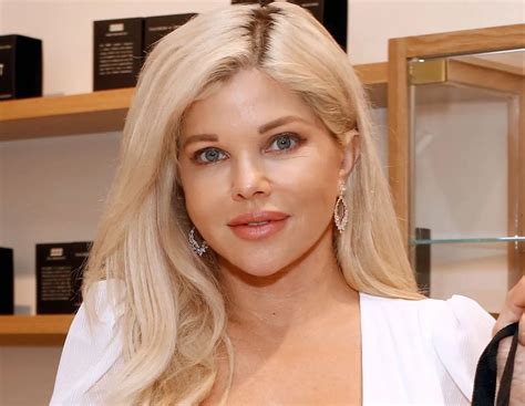Donna Derricos Journey Through Plastic Surgery Arm Lift And Tummy