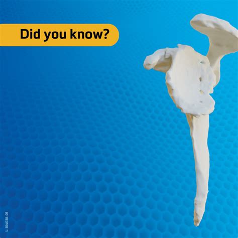 Shelley Day On Linkedin Did You Know 38 Of Our Complex Glenoid Cases