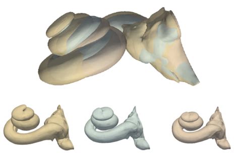 Three Virtual Patients From The Statistical Shape Model Are Overlapped