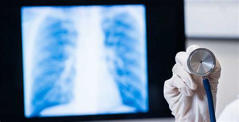 What Is Ipf Learning About A Rare Lung Disease