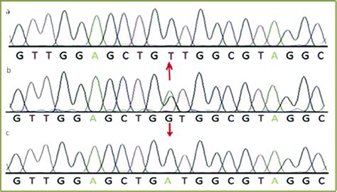 Represents Chromatogram Of A Direct Sequencing For Kras C34 G T Download Scientific