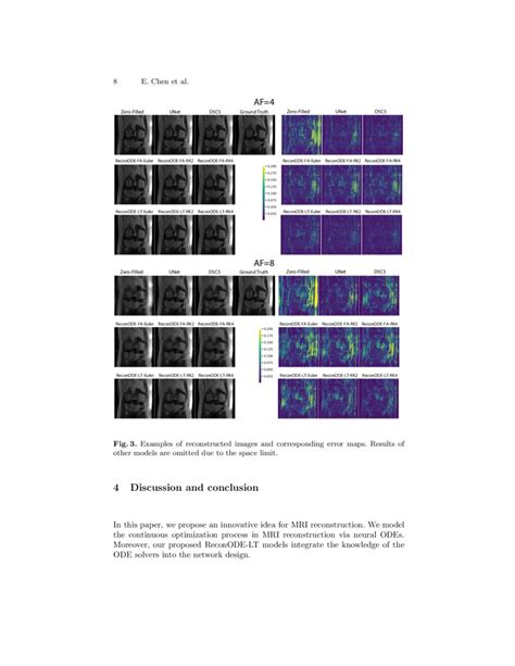 Mri Image Reconstruction Via Learning Optimization Using Neural Odes Deepai