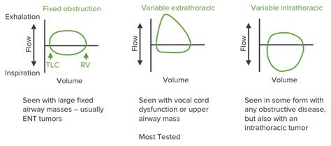 Pulmonary Function Tests Concise Medical Knowledge
