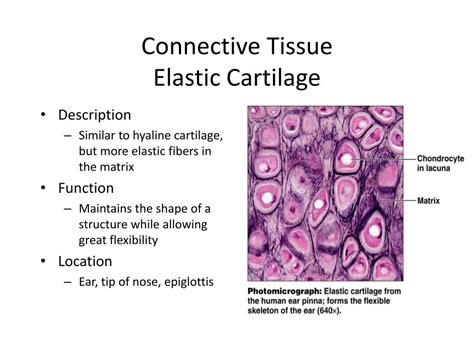 Diagram Of Elastic Connective Tissue Dense Irregular Connect