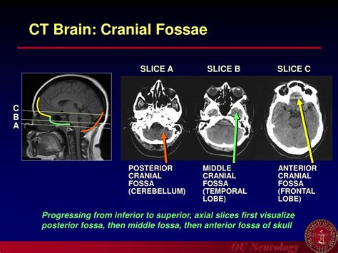 Ppt Introduction To Ct And Cta Imaging Principles Powerpoint