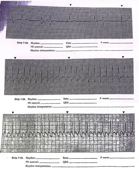 Solved 7 30 Rhythm Rate P Wave Pr Interval Qrs Rhythen