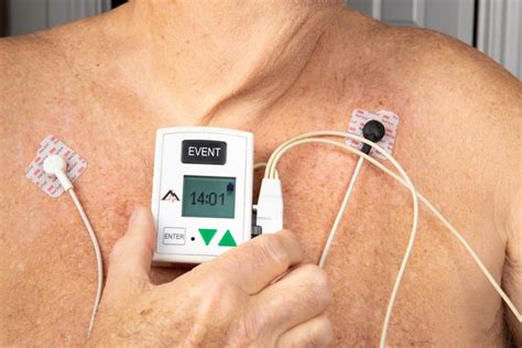 كل ما تريد معرفته عن جهاز تخطيط القلب المحمول الرجل