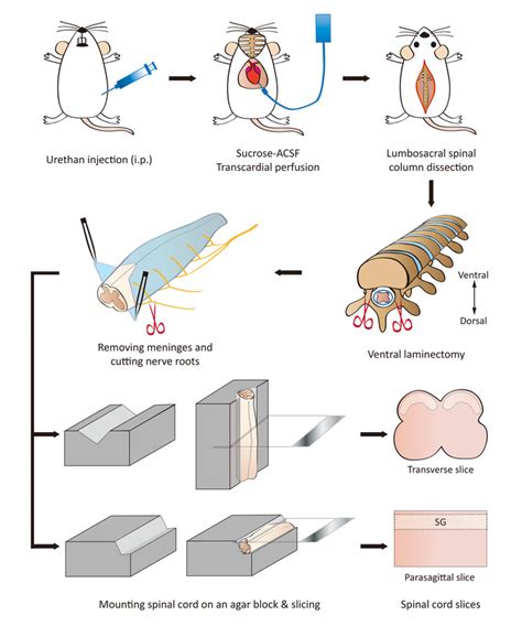 Preparation Of Acute Spinal Cord Slices For Whole Cell Patch Clamp Recording In Substantia