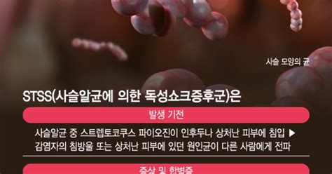 치사율 30 일본 휩쓴 전염병 의사 공백 한국 상륙땐 어쩌나