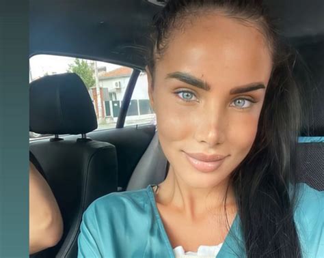 Aleksandra Subotić pokazala RANE u ustima