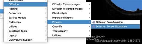 Li‘s 核磁共振影像数据处理 4 使用3d Slicer从dti计算参数图（fa、adc等）3d Slicer提取fa Csdn博客