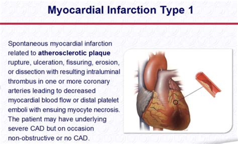 Exam 1 Cardiac Output Venous Return And Regulation Flashcards Quizlet