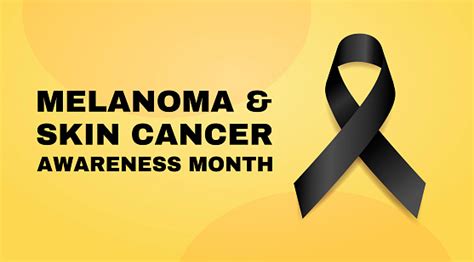 5월은 국립 흑색종과 피부암 인식의 달입니다 검은 리본 개념 배너 템플릿입니다 벡터 그림입니다 0명에 대한 스톡 벡터 아트 및 기타 이미지 Istock