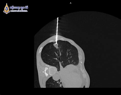 មន្ទីរពេទ្យ មន្ទីរពេទ្យ ហ្លួង ម៉ែ Luang MÈ Hospital