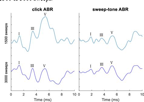 Figure 3 From Comparing Auditory Brainstem Responses Evoked By Click And Sweep Tone In Normal