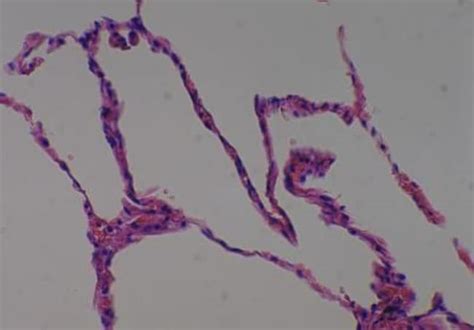 Novus Biologicals™ Human Lung Tissue Microarray Normal Human Lung
