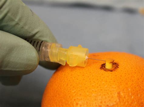 How Is A Scalp Biopsy Performed — Donovan Hair Clinic