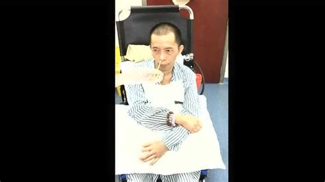 导管球囊扩张术 腾讯视频
