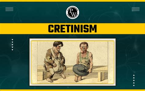Cretinism Types Causes Symptoms Diagnosis And Treatment