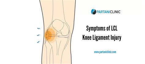 Symptoms Of Lcl Knee Ligament Injury Partani Clinic