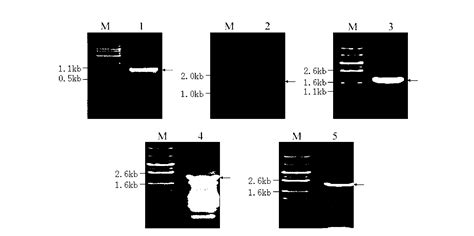 Alginate Lyase Biosynthesis Gene Cluster Eureka Patsnap