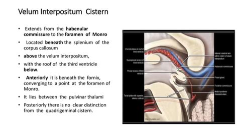 Anatomy Of Subarachnoid Cisterns Of Brain Ppt