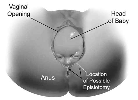 សំនួរដែលខ្ញុំលឺសួរញឹកញាប់រឿងតំបន់ពិសេ វេជ្ជបណ្ឌិត កម្ពុជា